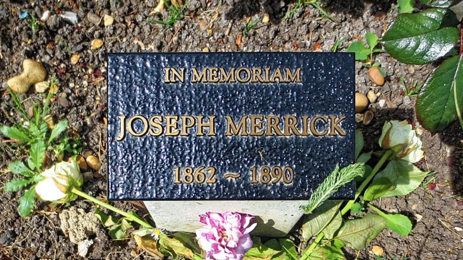 Elephant Man Disease Symptoms