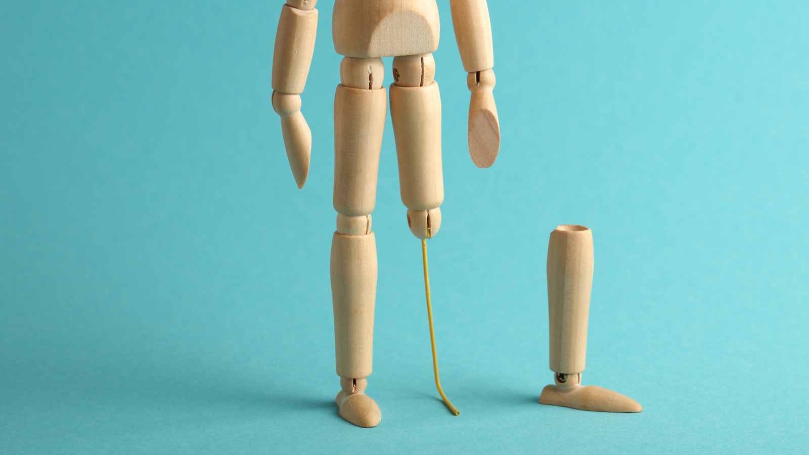 The First Recorded Successful Limb Amputation Is Much Older Than You Think