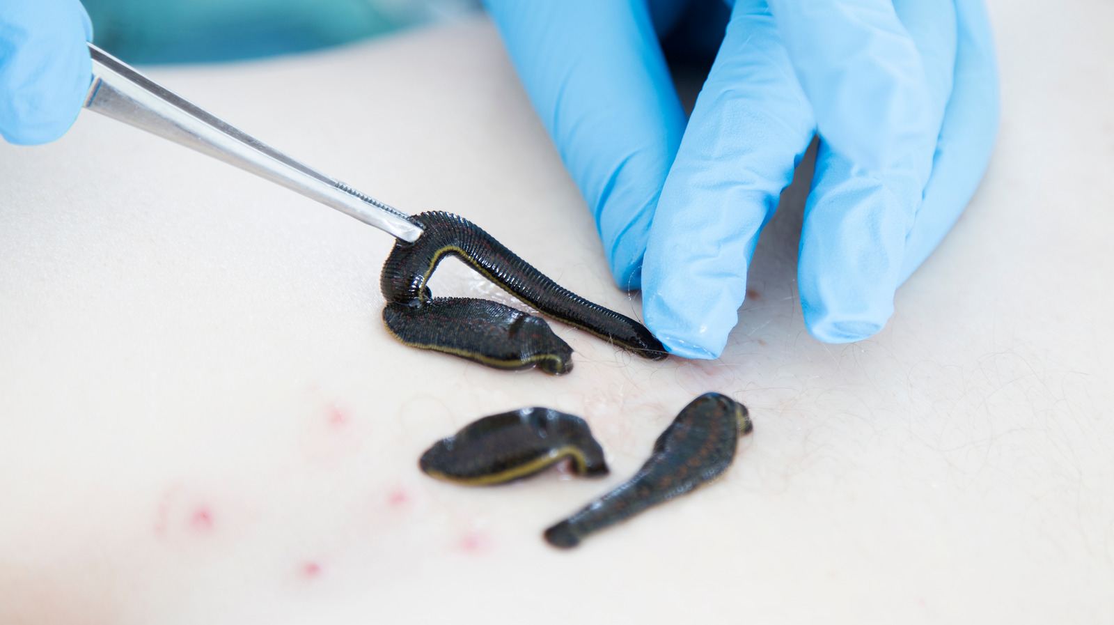 The Truth About Leech Collecting In The 1800s