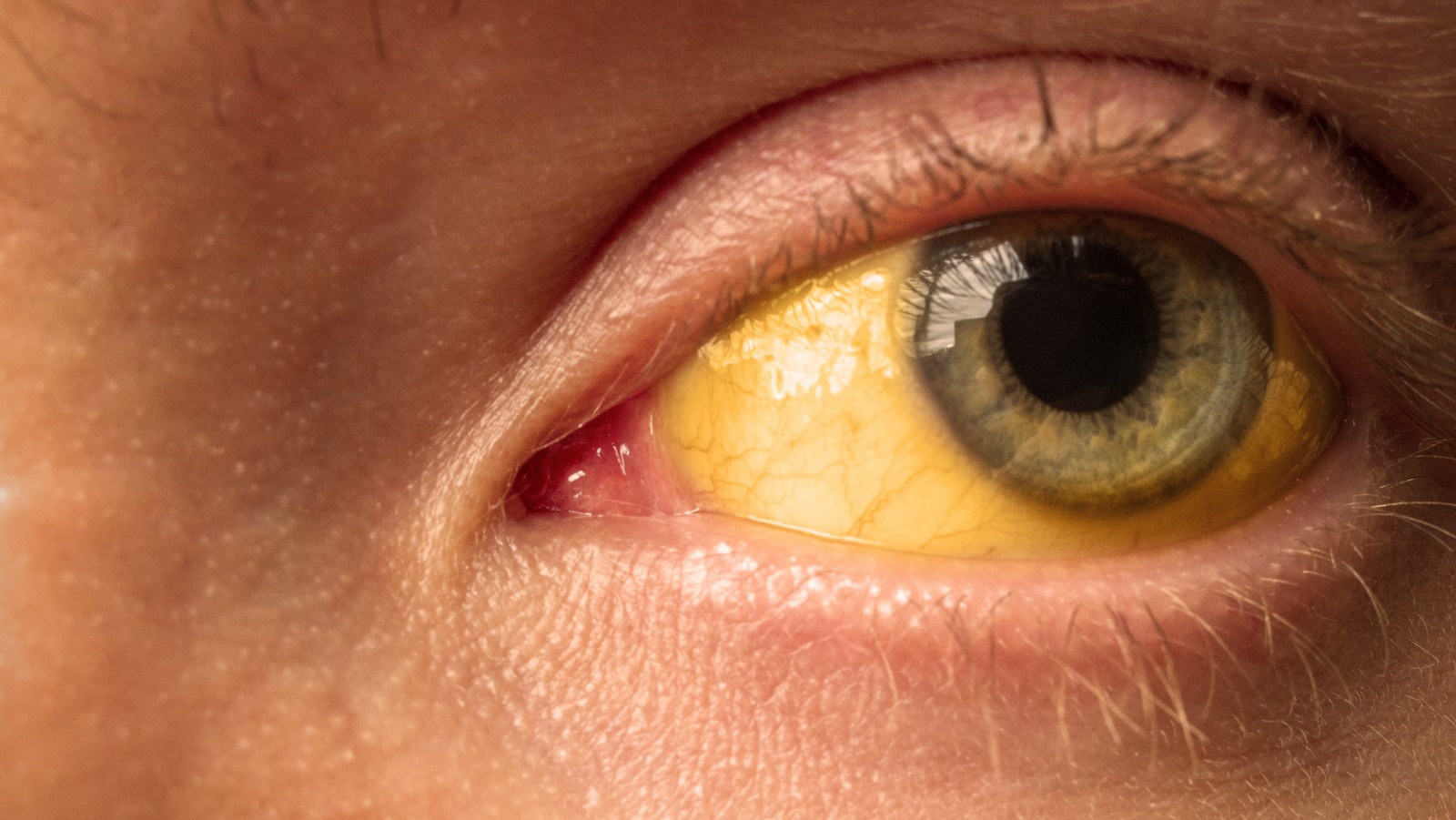 What It Really Means When Your Eyes Turn Yellow What It Really Means When Your Eyes Turn Yellow