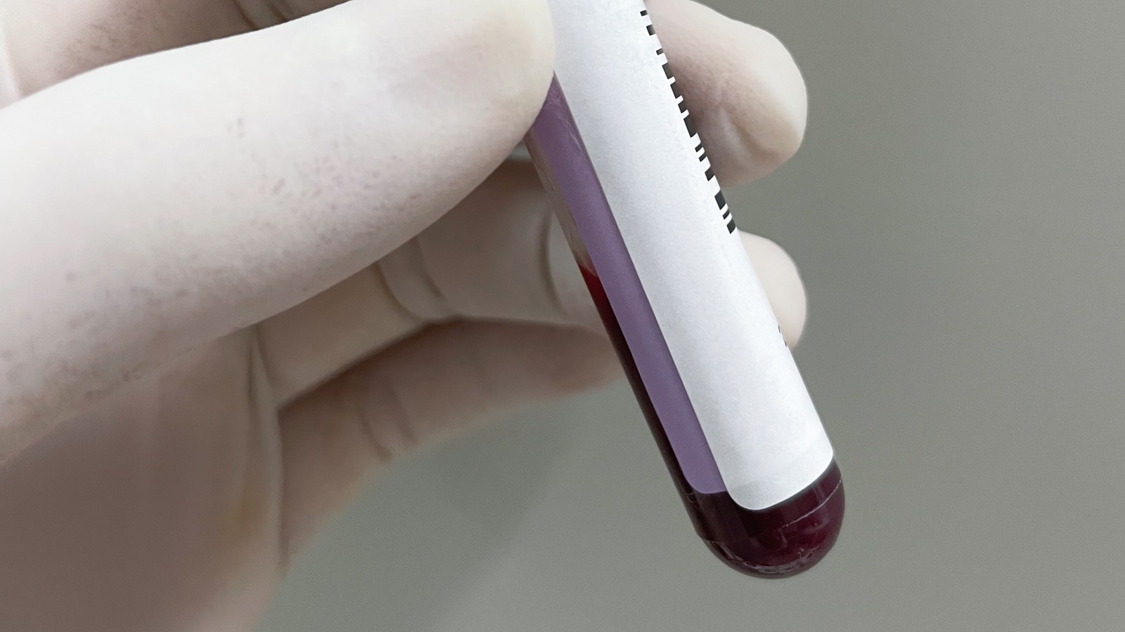 Why Golden Blood Is So Valuable